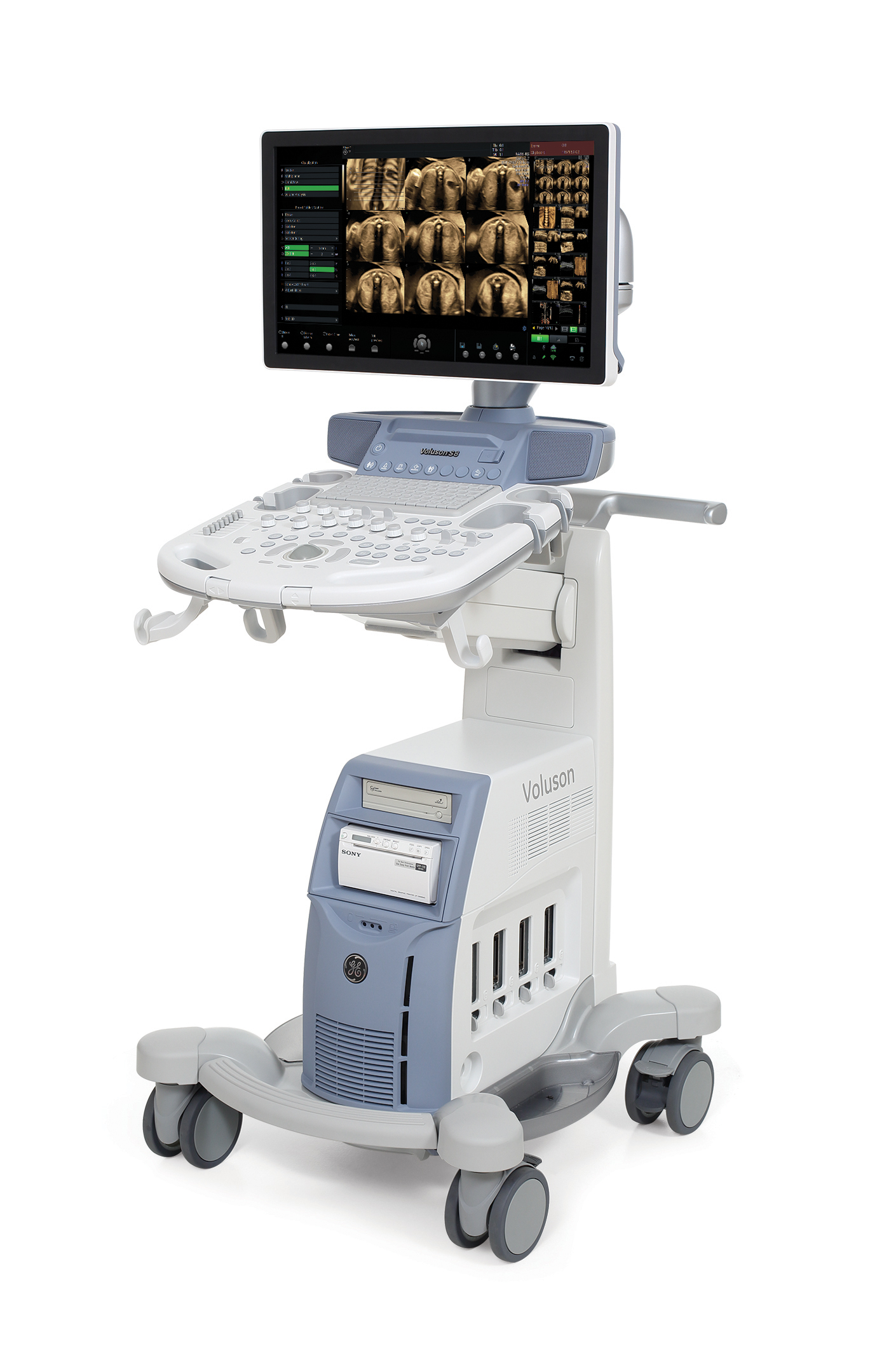 Voluson S8 - Tradintek